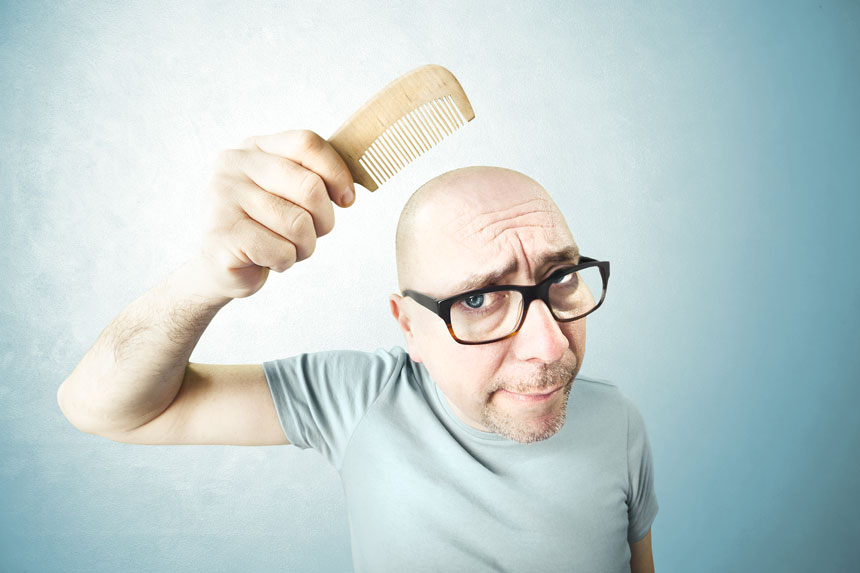 The weirdest baldness cure you'll ever hear of | The New Daily