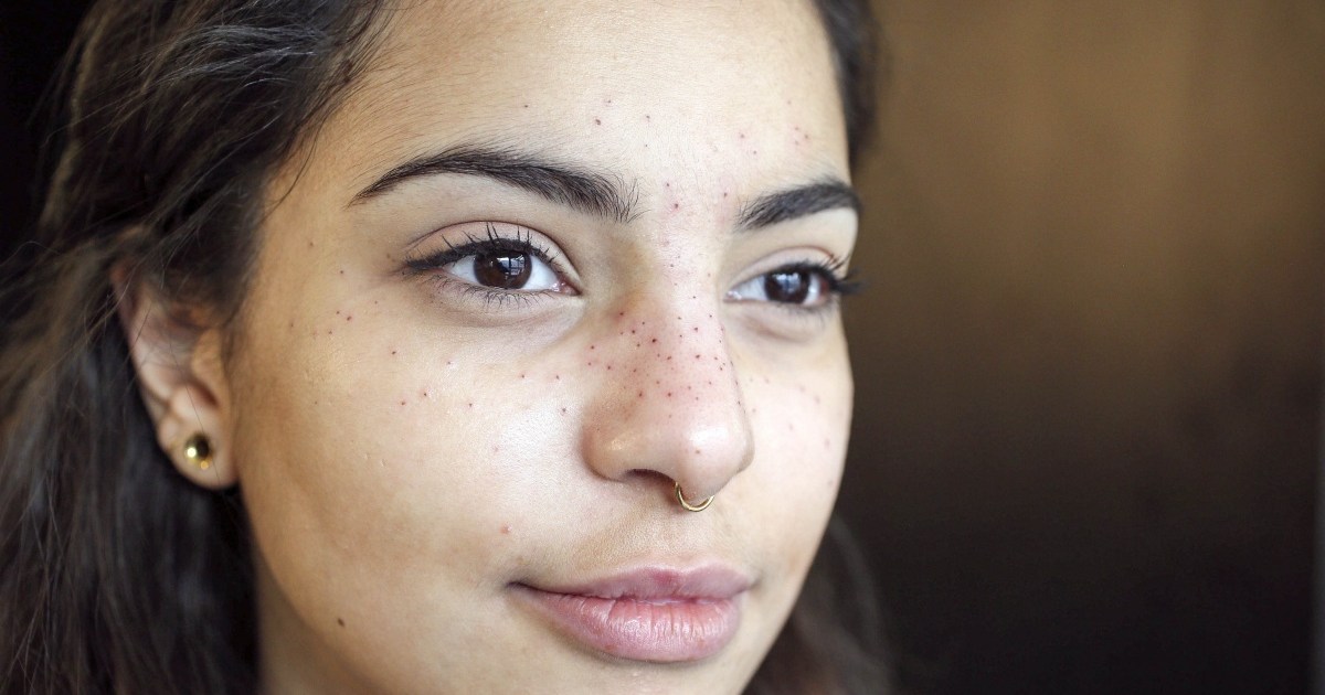 The tattoo freckles beauty trend has hit Australia