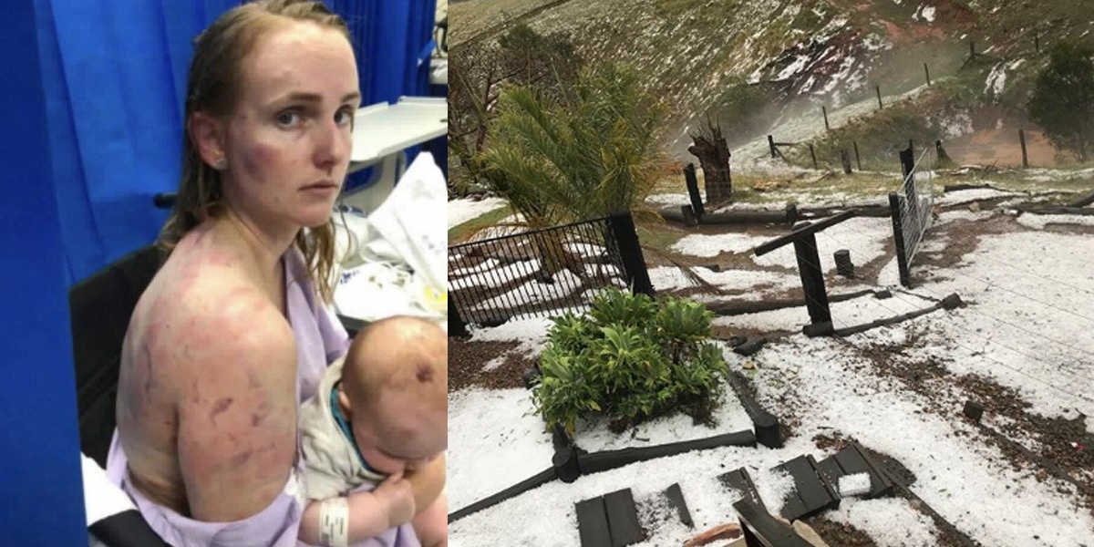 Hail pelts mother's skin raw in Queensland supercell storm