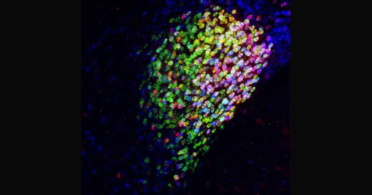 Pain switch: The latest discovery from our clever brains