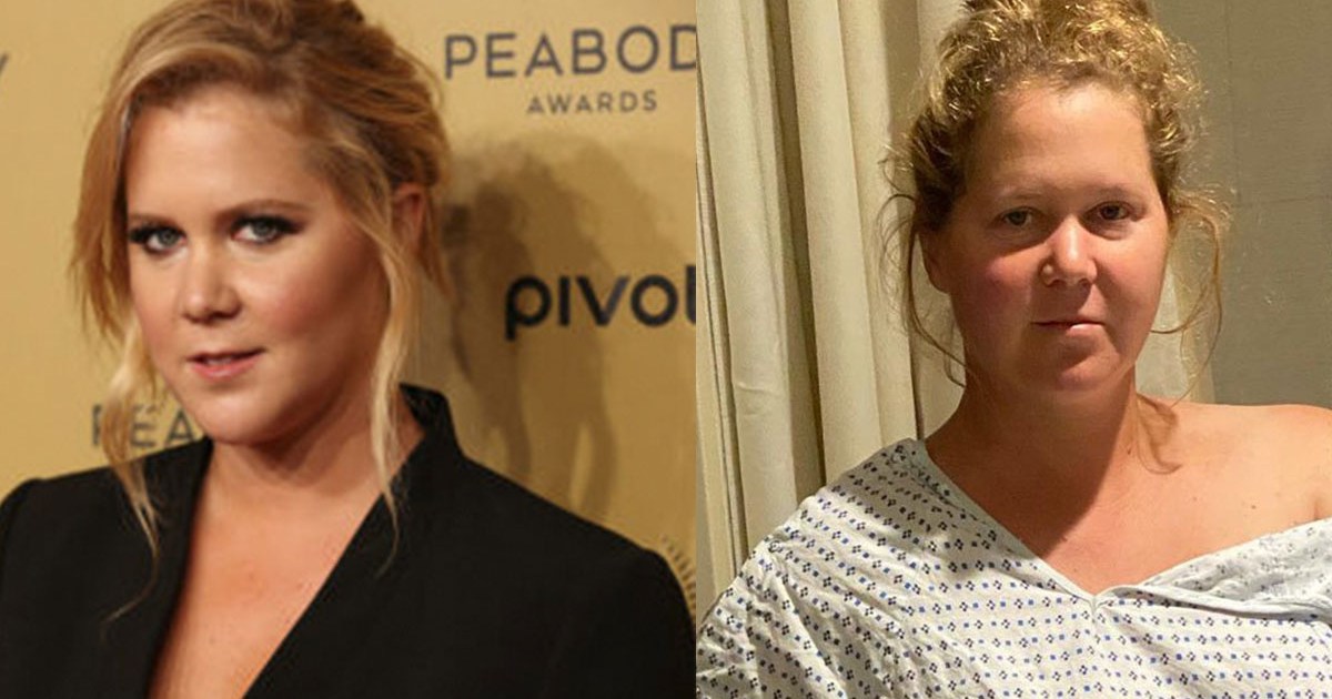 Amy Schumer posts personal video from hospital bed | The New Daily