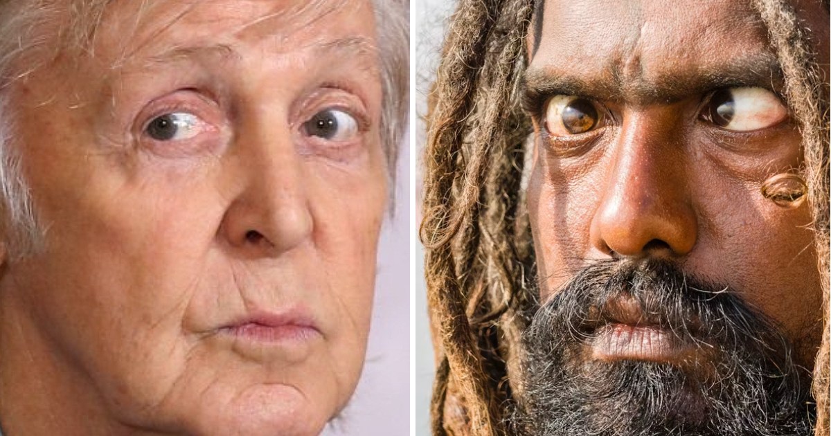 The truth about Paul McCartney's eye yoga