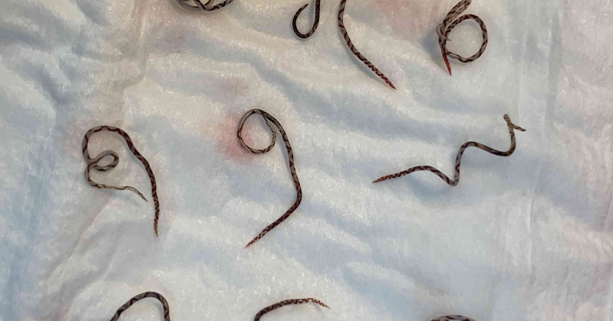 Australian warning for a rise in devastating rat lungworm disease