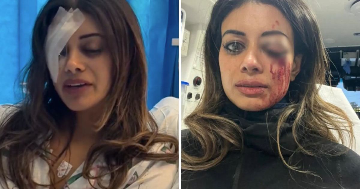 Officer charged over violent arrest that maimed activist