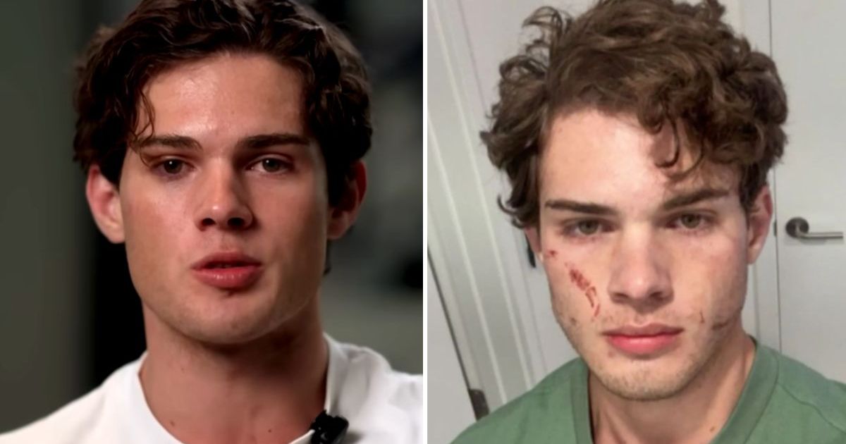 Inside the bizarre and disturbing trend of ‘looksmaxxing’